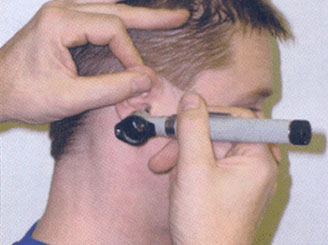 Impression Techniques - Great Lakes Earmold Lab