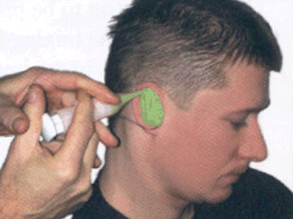 Impression Techniques - Great Lakes Earmold Lab